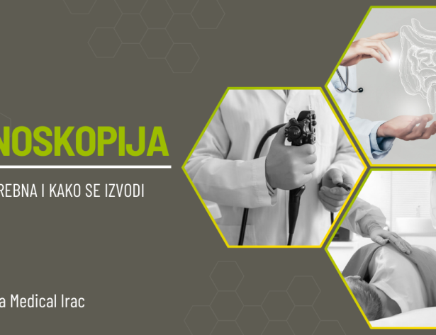 ASTO- antistreptolizinski test - Poliklinika Irac