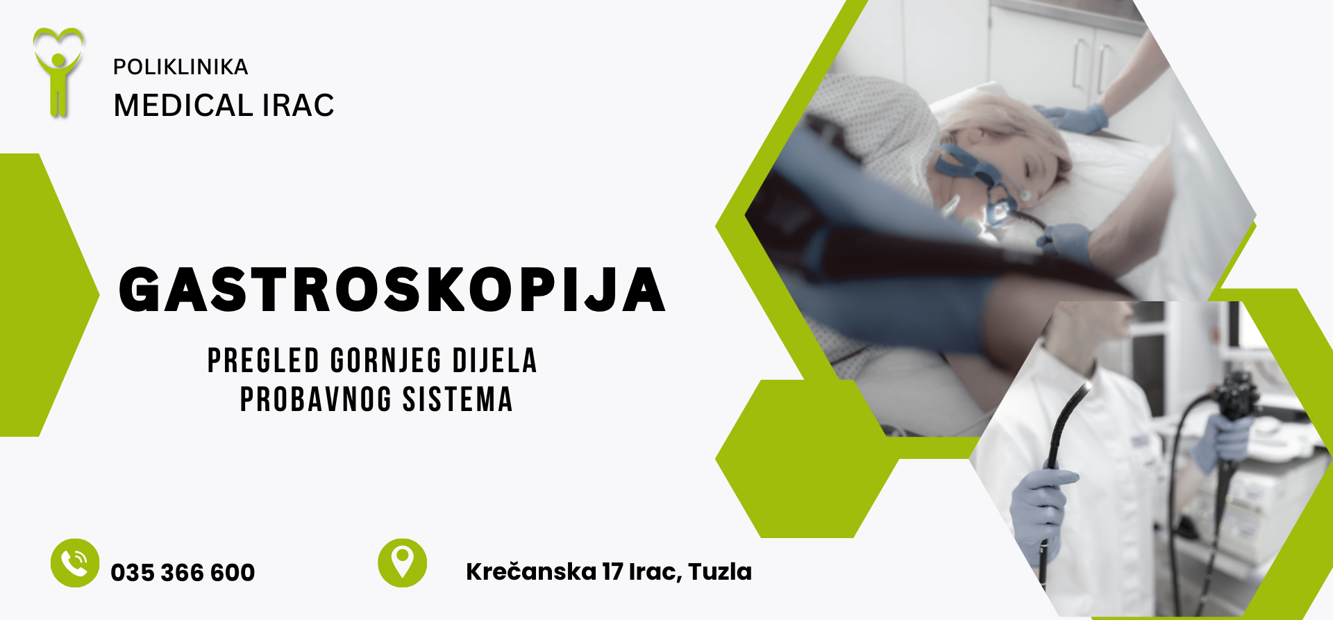 GASTROSKOPIJA – kome je potrebna, priprema i kako se izvodi ...