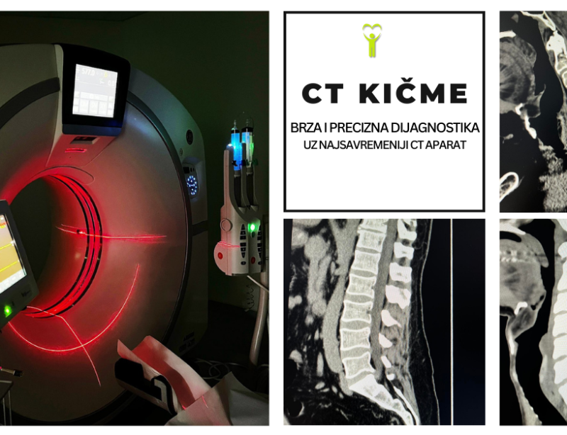 kompjuterizovanatomografija Archives - Poliklinika Irac