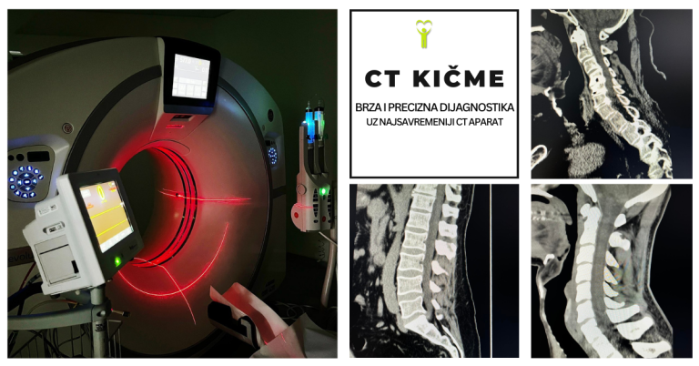 CT kičme - prednosti ove vrste dijagnostike - Poliklinika Irac
