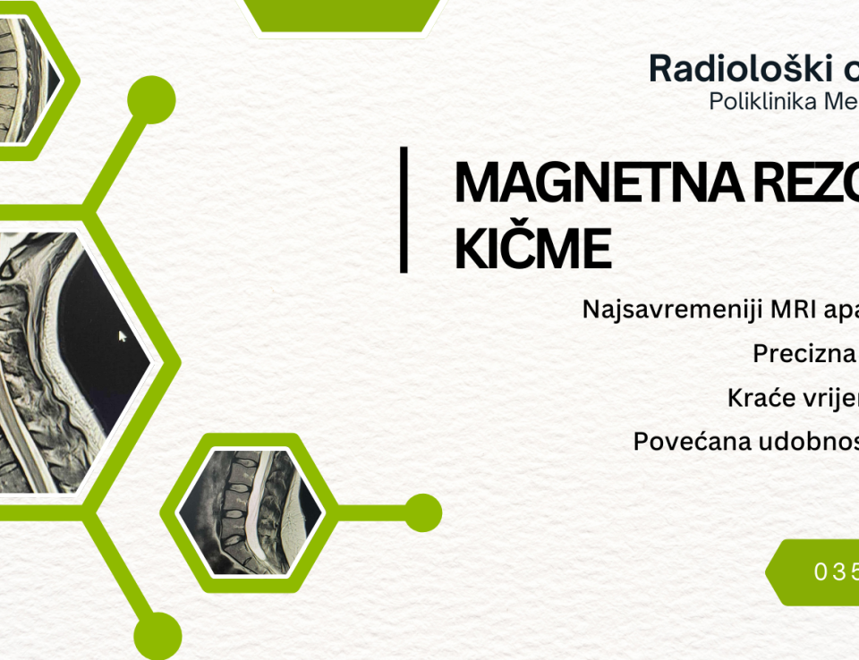 RTG PLUĆA - Kada je potrebno snimanje i šta otkriva? - Poliklinika Irac